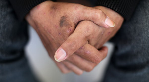 Australia strengthens leadership role in global HIV/AIDS fight ...